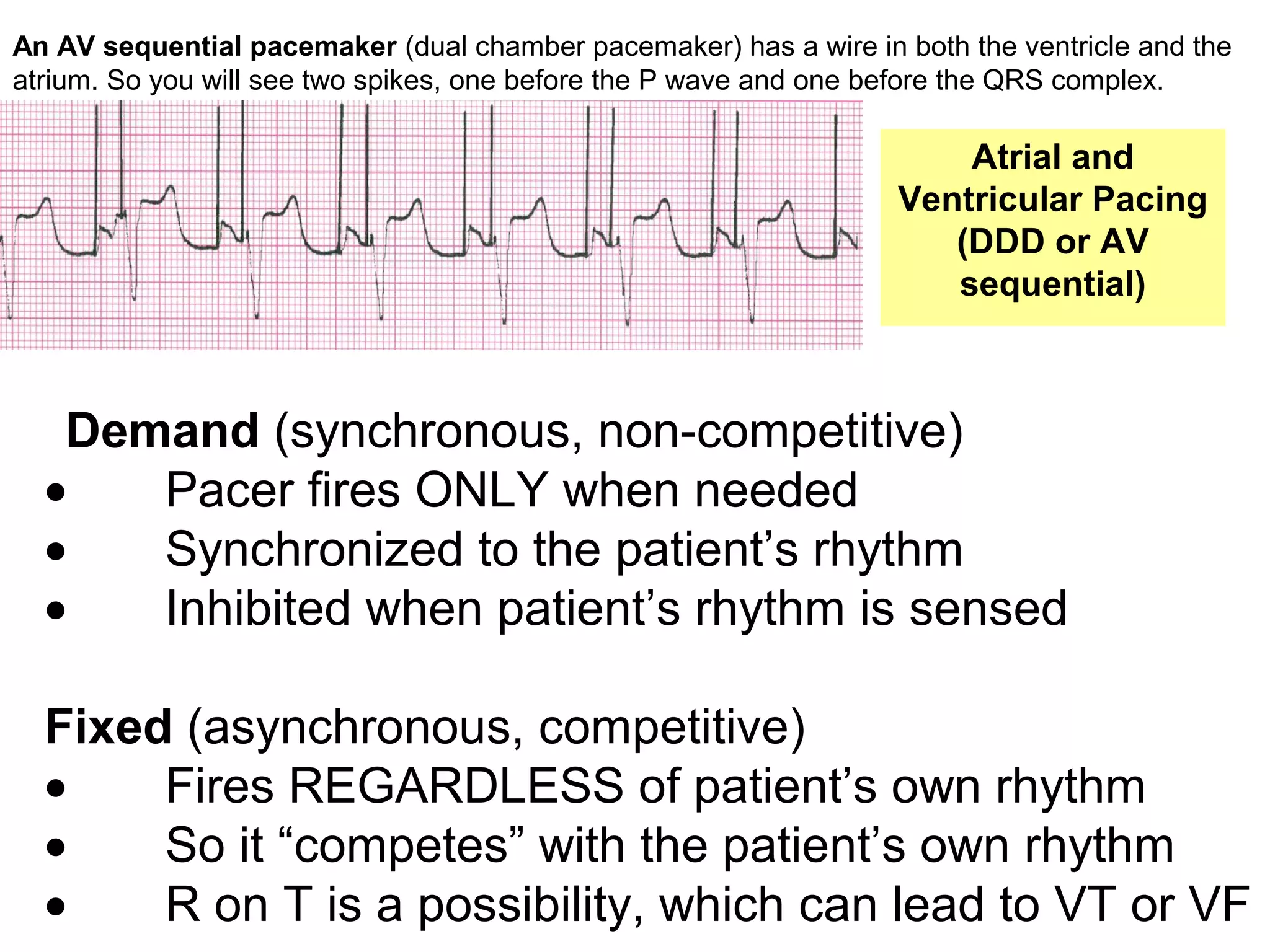 Algorithm for Rhythm Interpretation1 | PPT