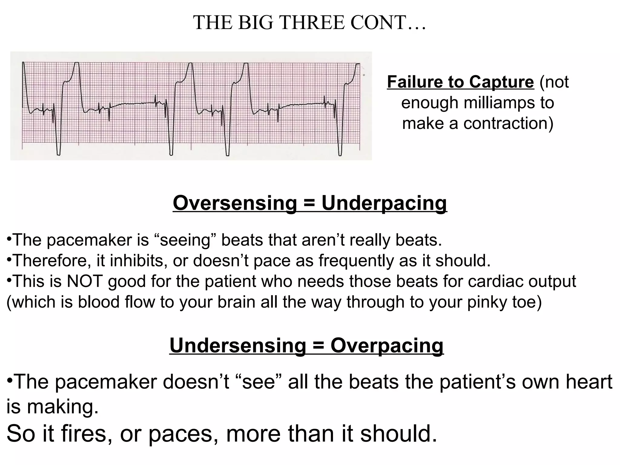 Algorithm for Rhythm Interpretation1 | PPT