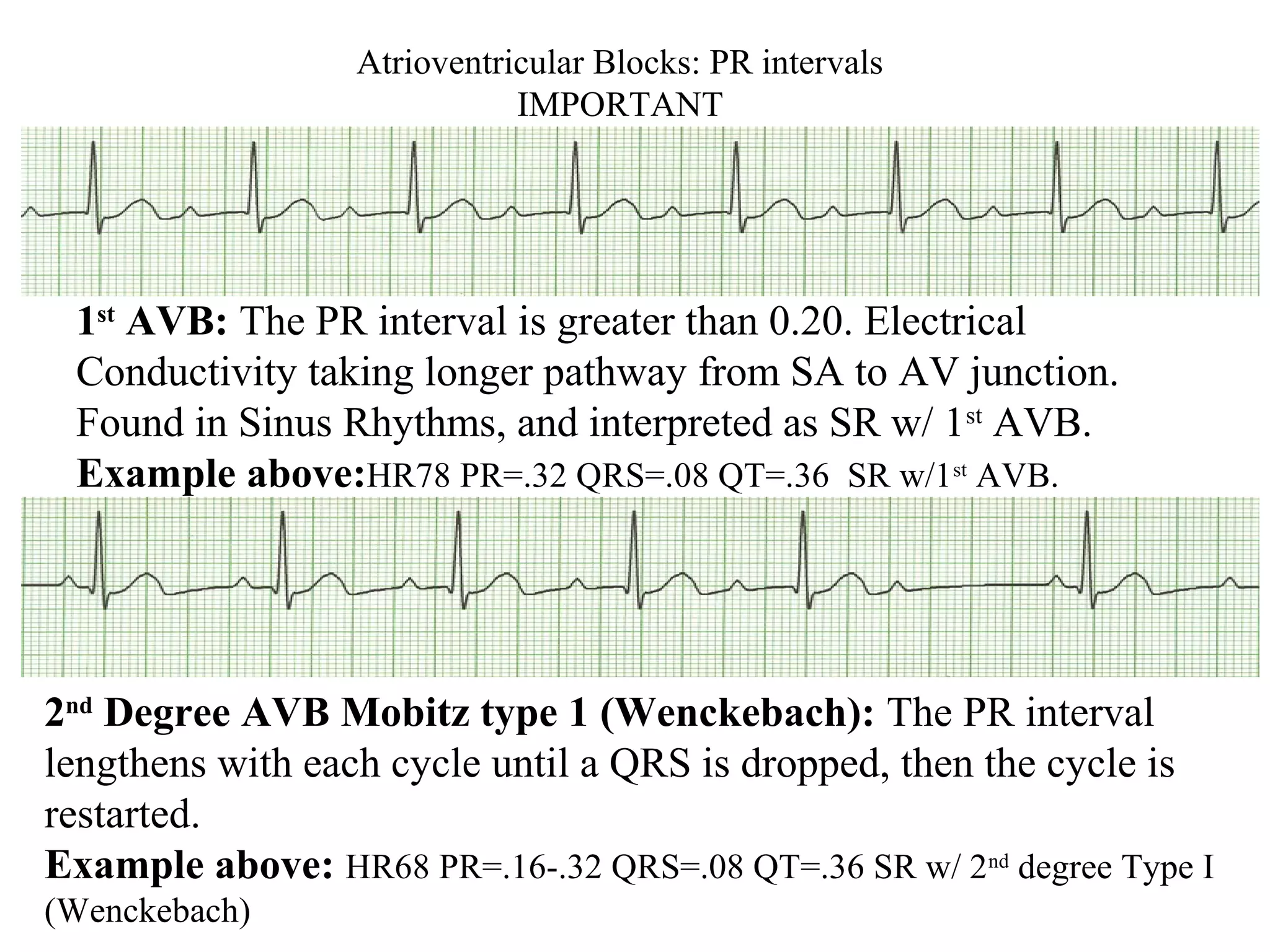 Algorithm for Rhythm Interpretation1 | PPT