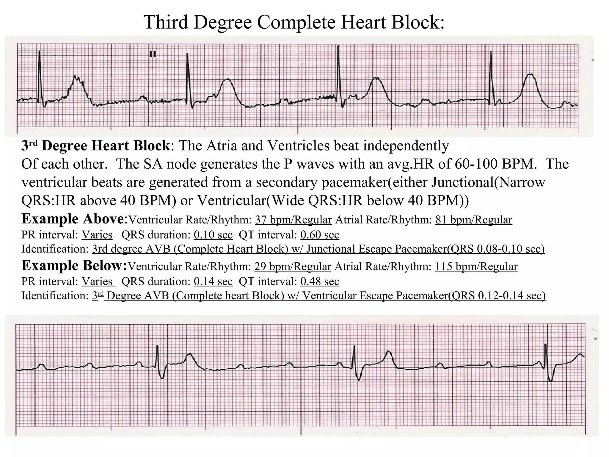 Algorithm for Rhythm Interpretation1 | PPT