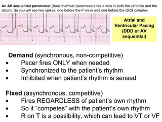 Algorithm for Rhythm Interpretation1 | PPT