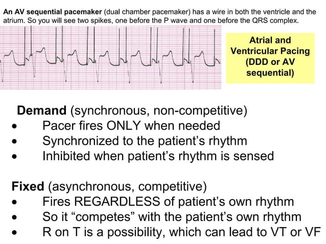 Algorithm for Rhythm Interpretation1 | PPT