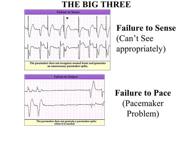 Algorithm for Rhythm Interpretation1 | PPT
