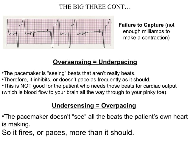Algorithm for Rhythm Interpretation1 | PPT