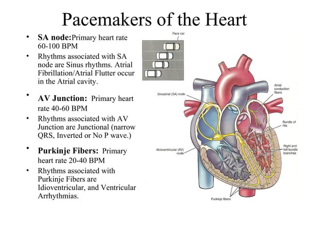 Algorithm for Rhythm Interpretation1 | PPT