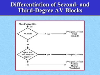 Algorithm for Rhythm Interpretation1 | PPT