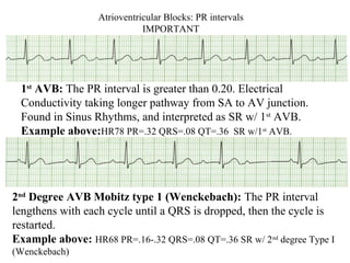 Algorithm for Rhythm Interpretation1 | PPT