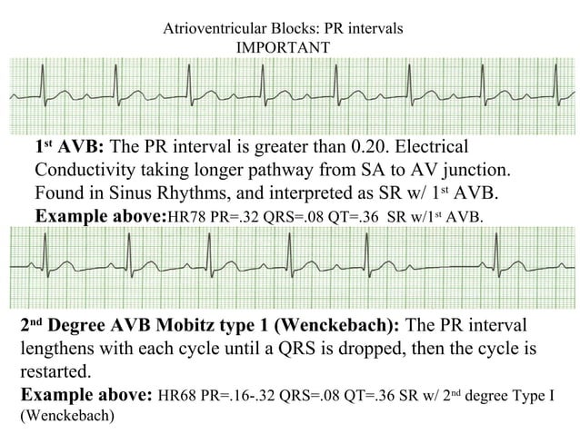 Algorithm for Rhythm Interpretation1 | PPT