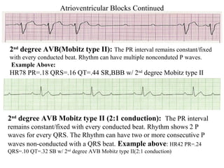 Algorithm for Rhythm Interpretation1 | PPT