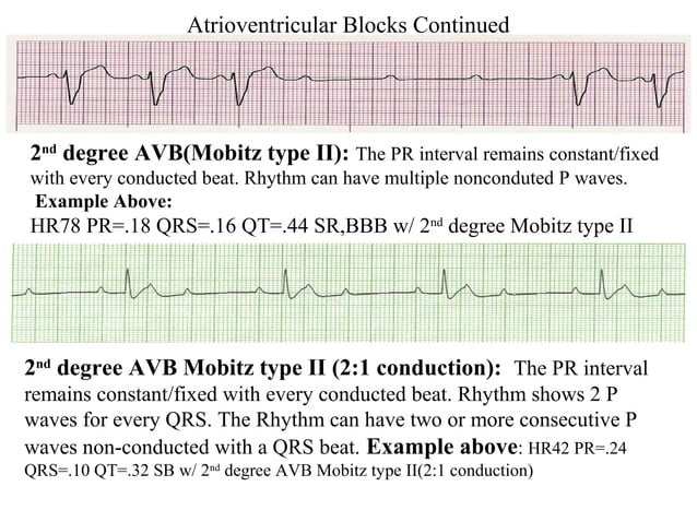 Algorithm for Rhythm Interpretation1 | PPT