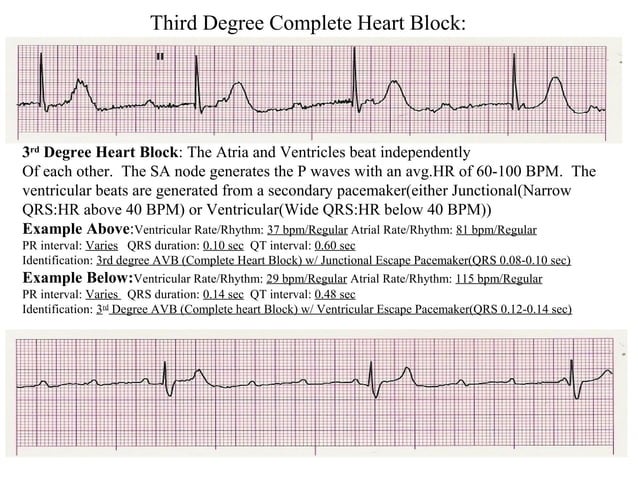 Algorithm for Rhythm Interpretation1 | PPT