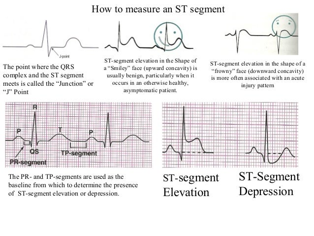Algorithm for Rhythm Interpretation1
