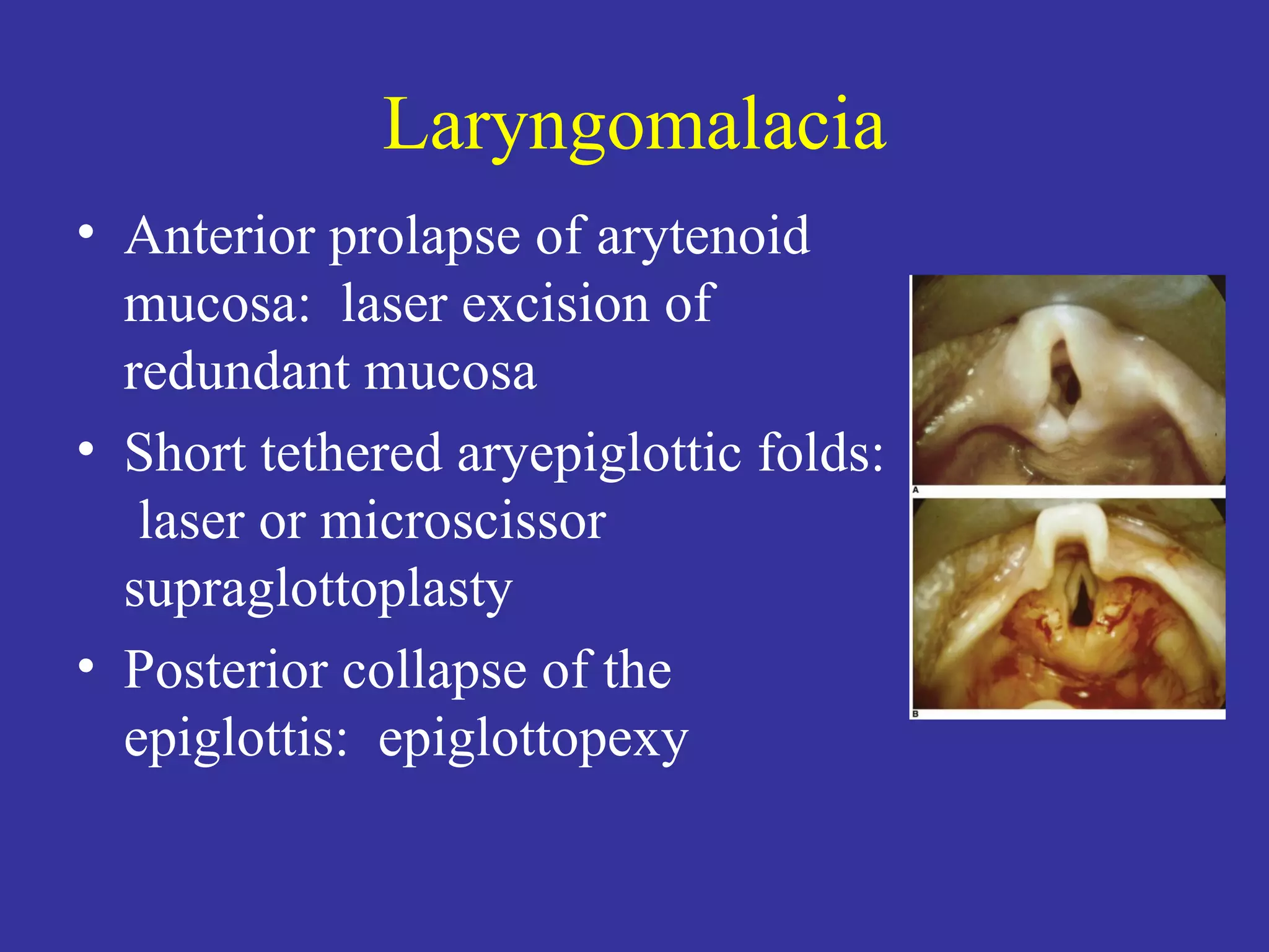 Cd6e Coclia86 Neonatal Resp Distress | PPT