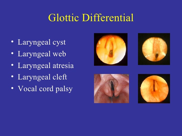 Cd6e Coclia86 Neonatal Resp Distress