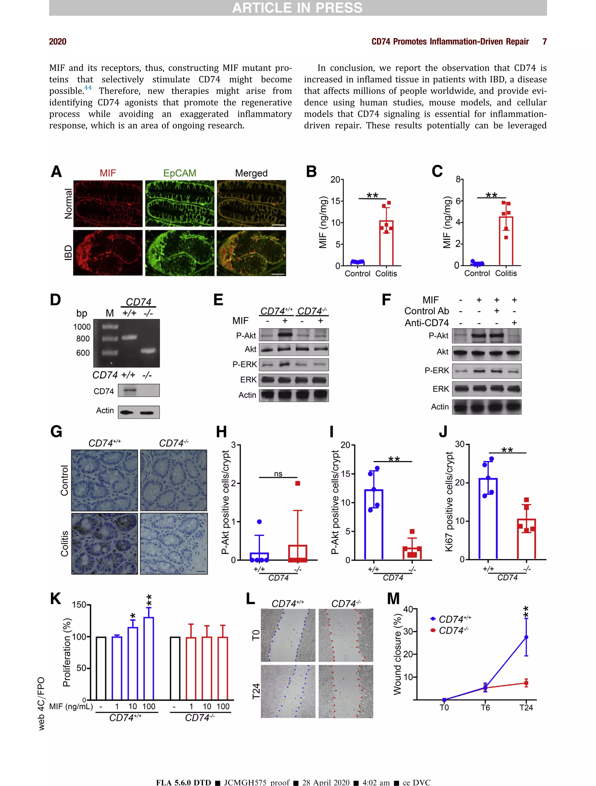 A study describing how the MIF cytokine/CD74 receptor pathway heals the ...