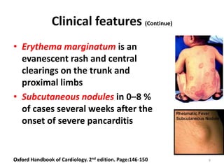 Rheumatic Fever | PDF