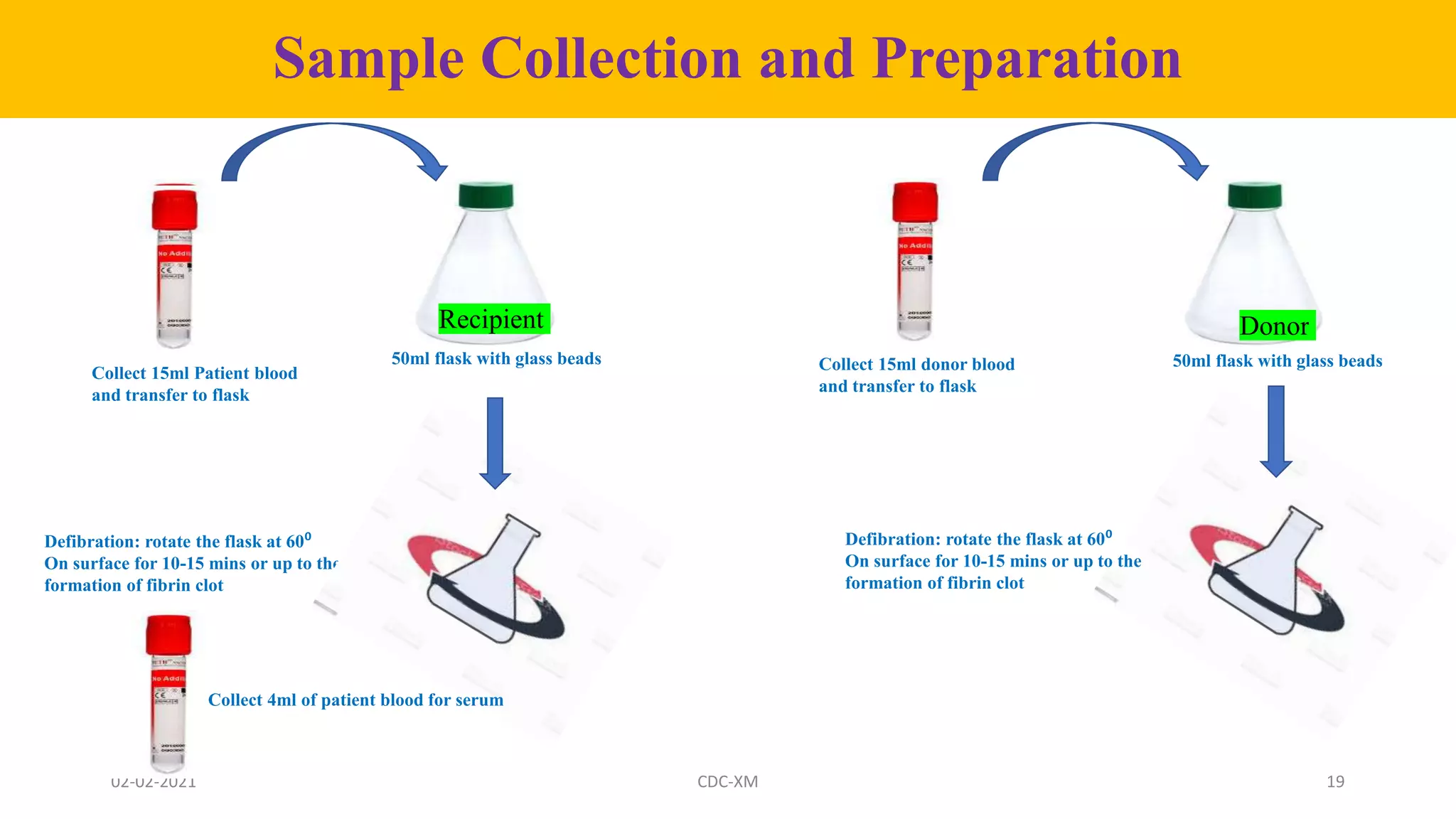 CDC-XM / Complement dependent cytotoxicity -crossmatch | PPTX