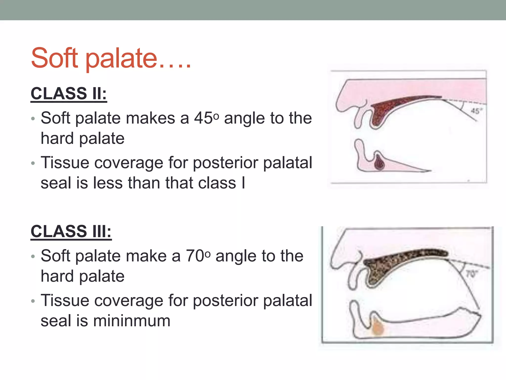 Complete denture case history | PPTX