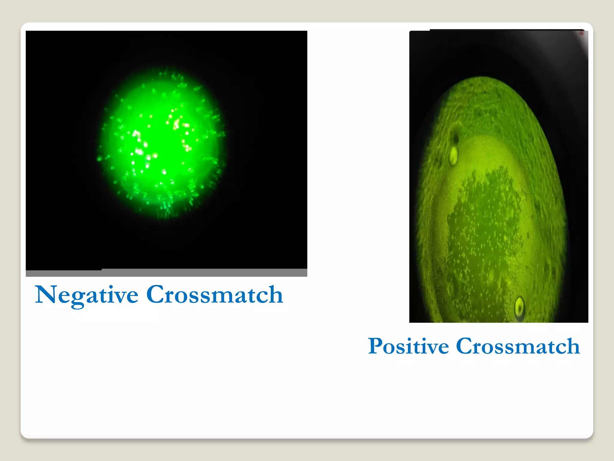 CdC CROSSMATCH(CDCXM) | PDF