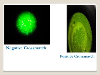 CdC CROSSMATCH(CDCXM) | PDF