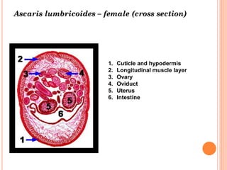 Ascaris Lumbricoides Male And Female Cross Section