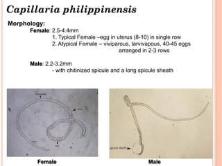 Capillaria Philippinensis Egg