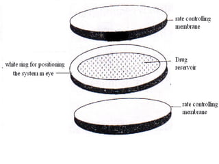 CONTROLLED DRUG DELIVERY SYSTEMS | PPT