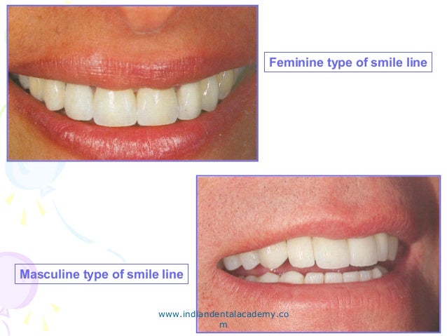 Complete denture esthetics/ cosmetic dentistry training