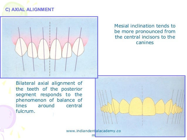 Complete denture esthetics/ cosmetic dentistry training