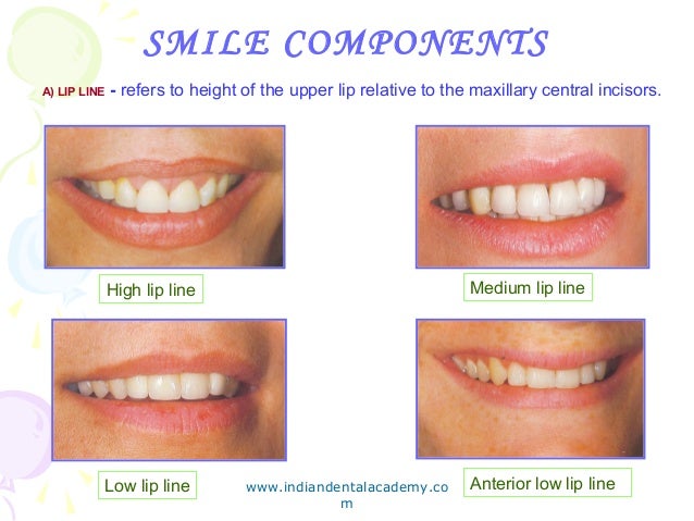 Complete denture esthetics/endodontic courses