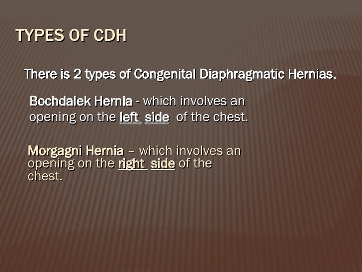 cdh