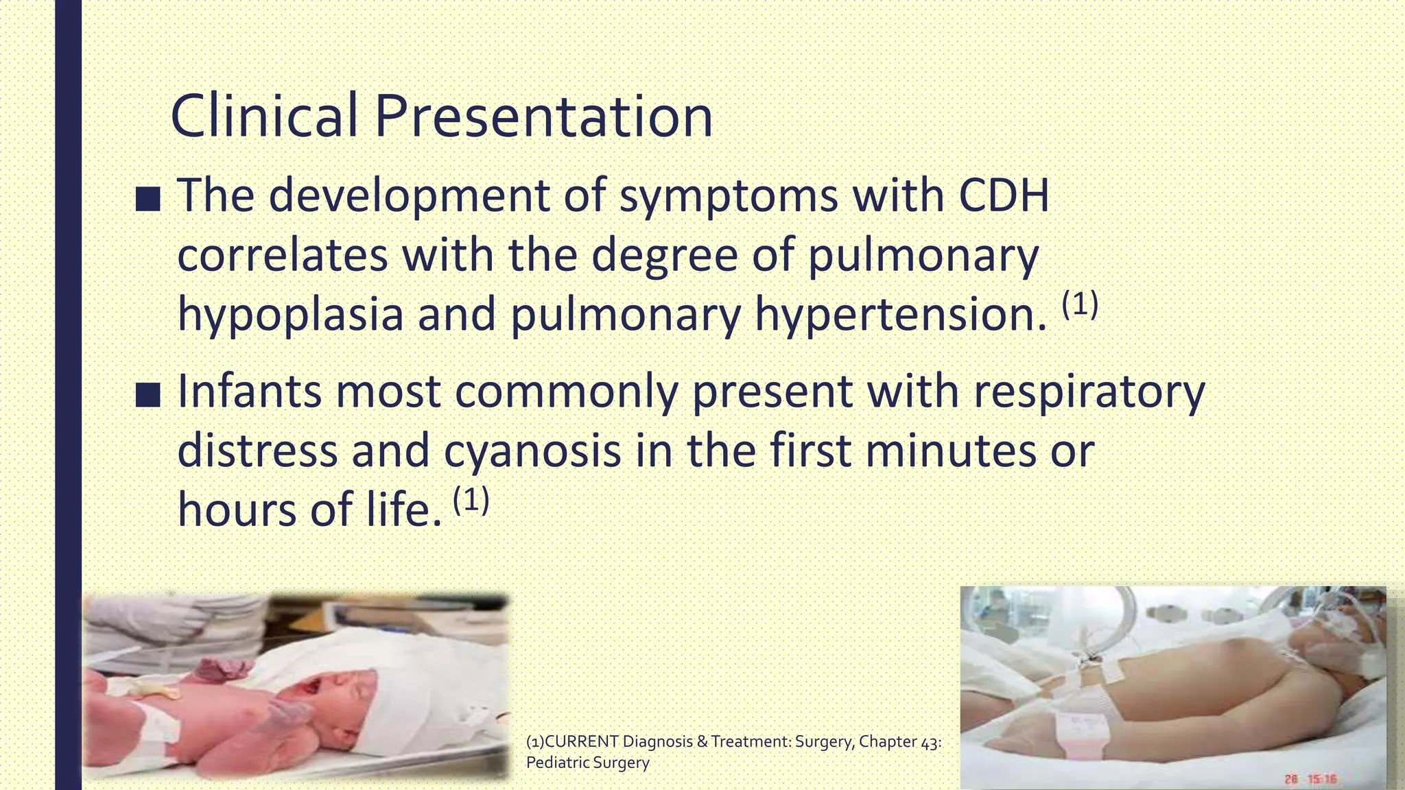CONGENITAL DIAPHRAGMATIC HERNIA (CDH) | PPTX