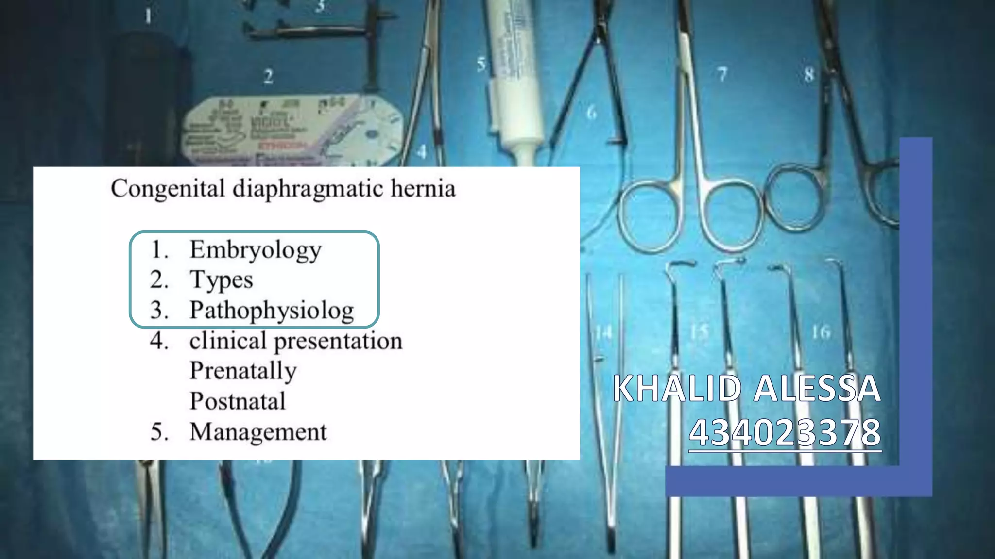 CONGENITAL DIAPHRAGMATIC HERNIA (CDH) | PPTX