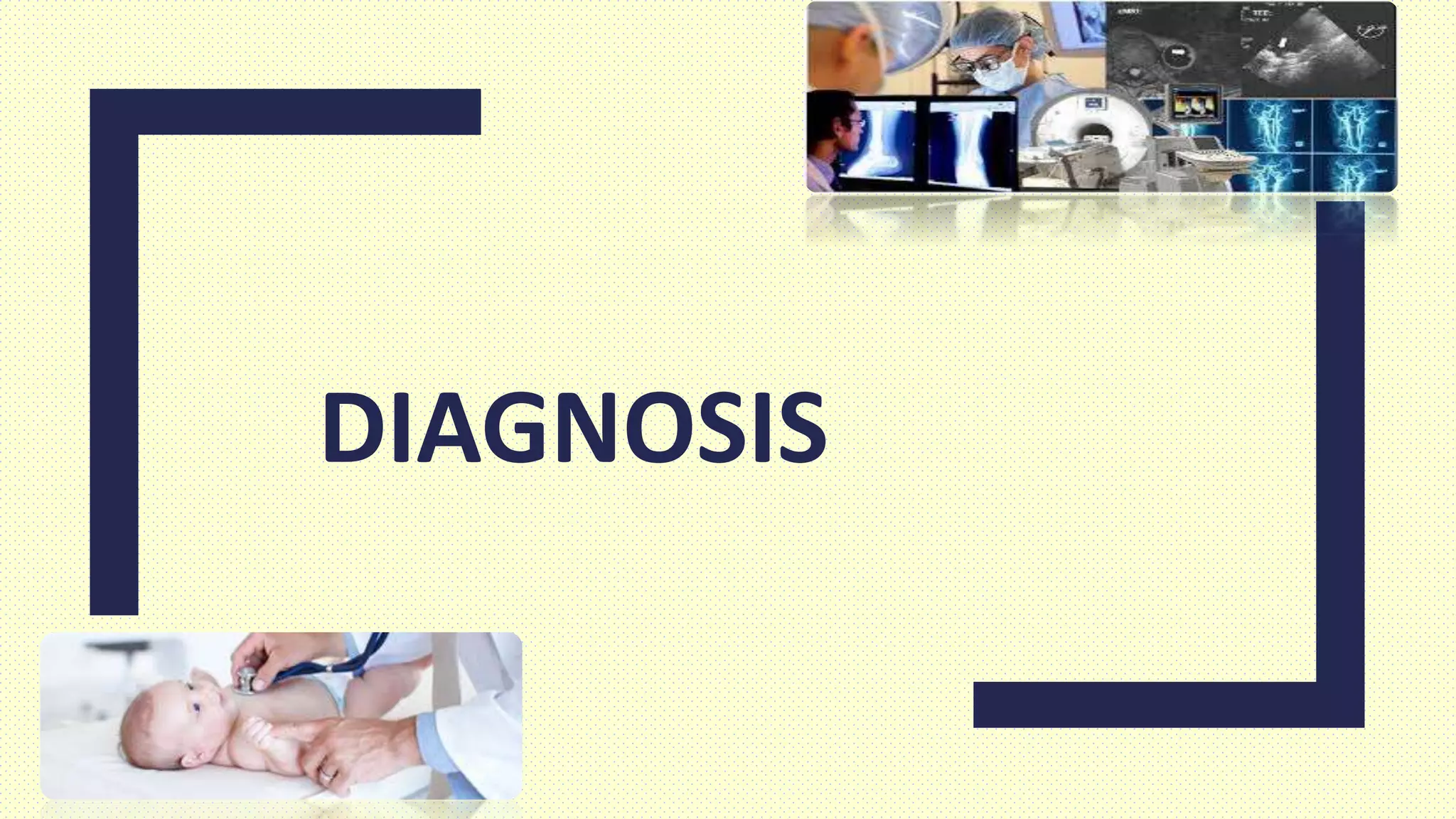 CONGENITAL DIAPHRAGMATIC HERNIA (CDH) | PPTX