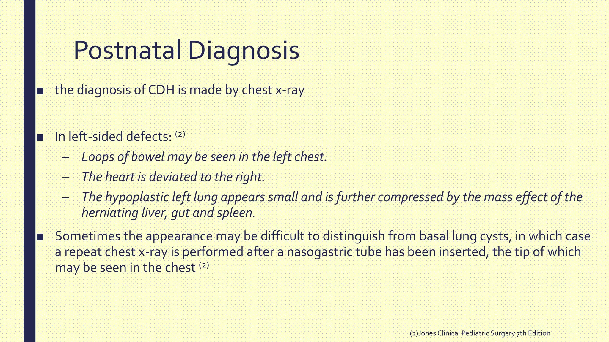 CONGENITAL DIAPHRAGMATIC HERNIA (CDH) | PPTX