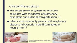 CONGENITAL DIAPHRAGMATIC HERNIA (CDH) | PPTX