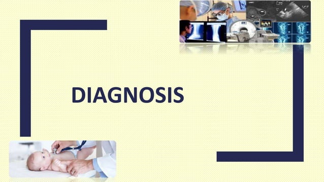 CONGENITAL DIAPHRAGMATIC HERNIA (CDH) | PPTX