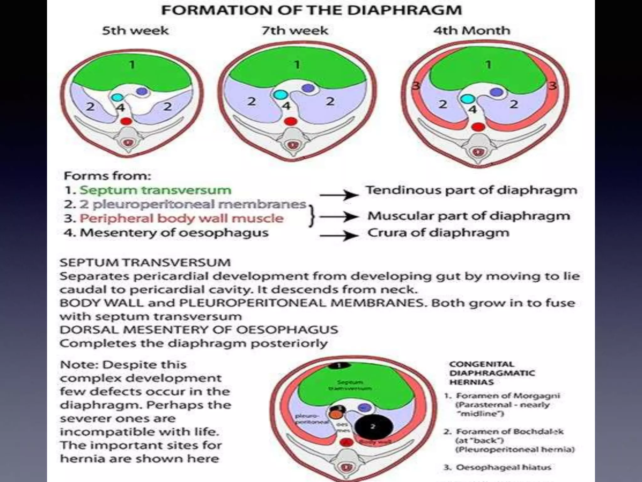 Congenital diaphragmatic hernia (CDH) | PPT