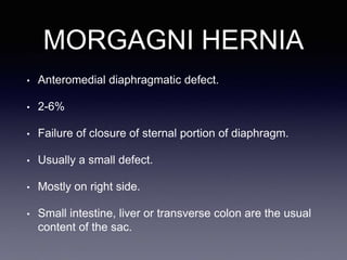 Congenital diaphragmatic hernia (CDH) | PPT