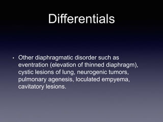 Congenital diaphragmatic hernia (CDH) | PPT