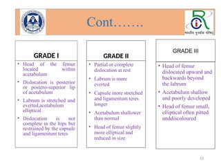 Assessment protocol and importance of Orthotic Management of Congenital ...