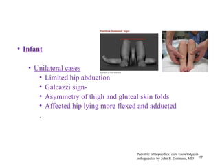 Assessment protocol and importance of Orthotic Management of Congenital ...