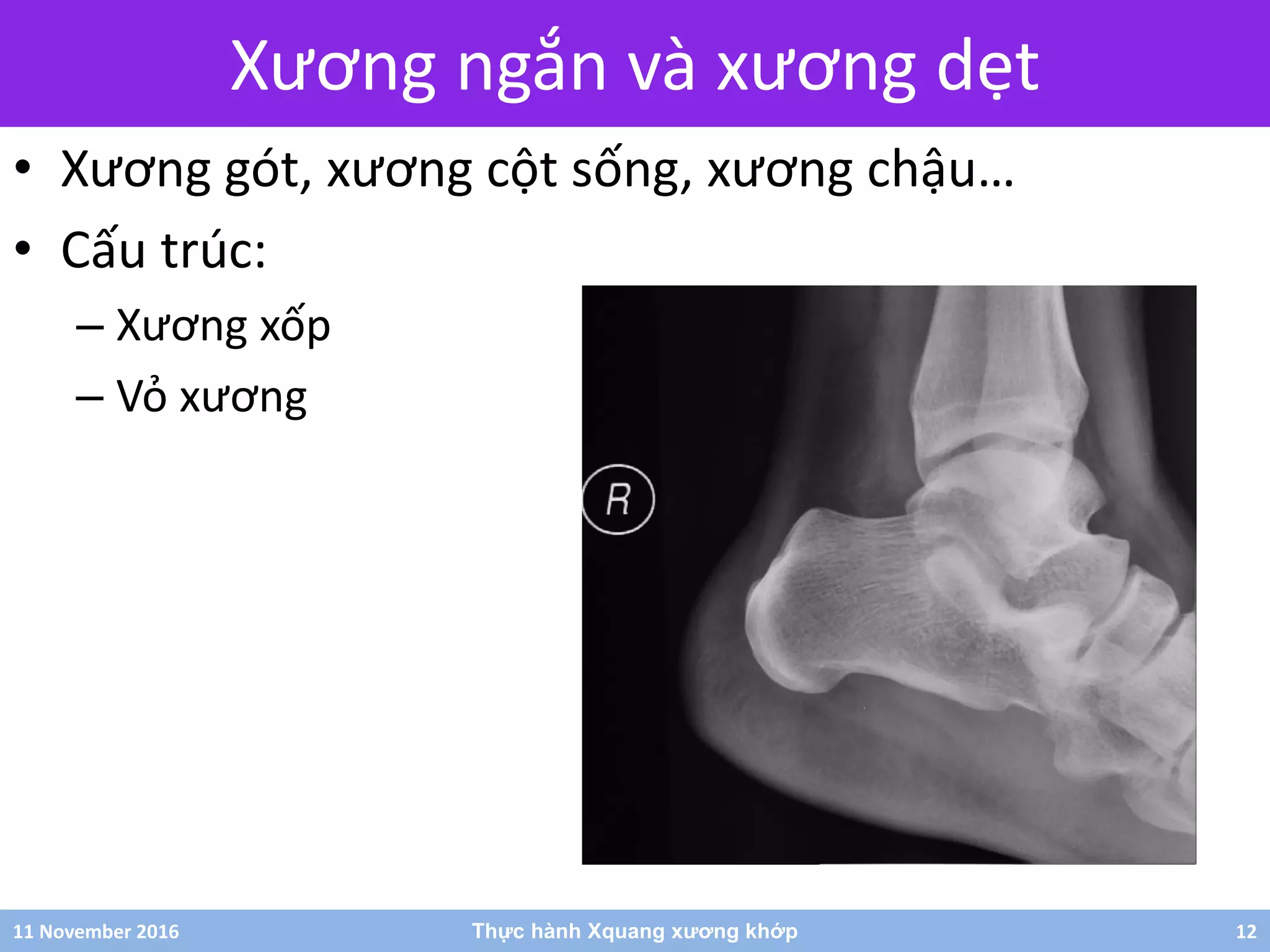 Thực hành X quang xương khớp | PDF