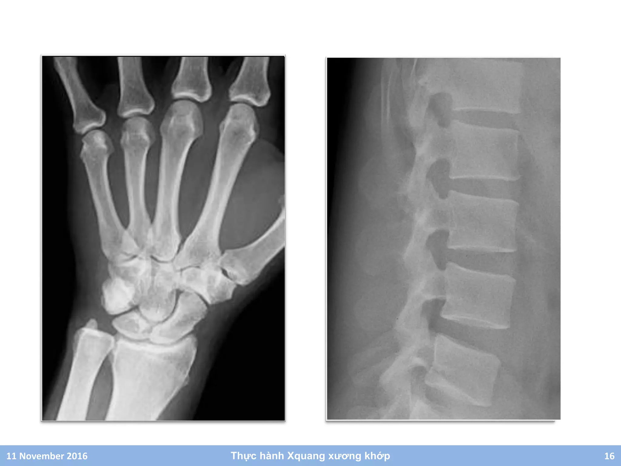 Thực hành X quang xương khớp | PDF