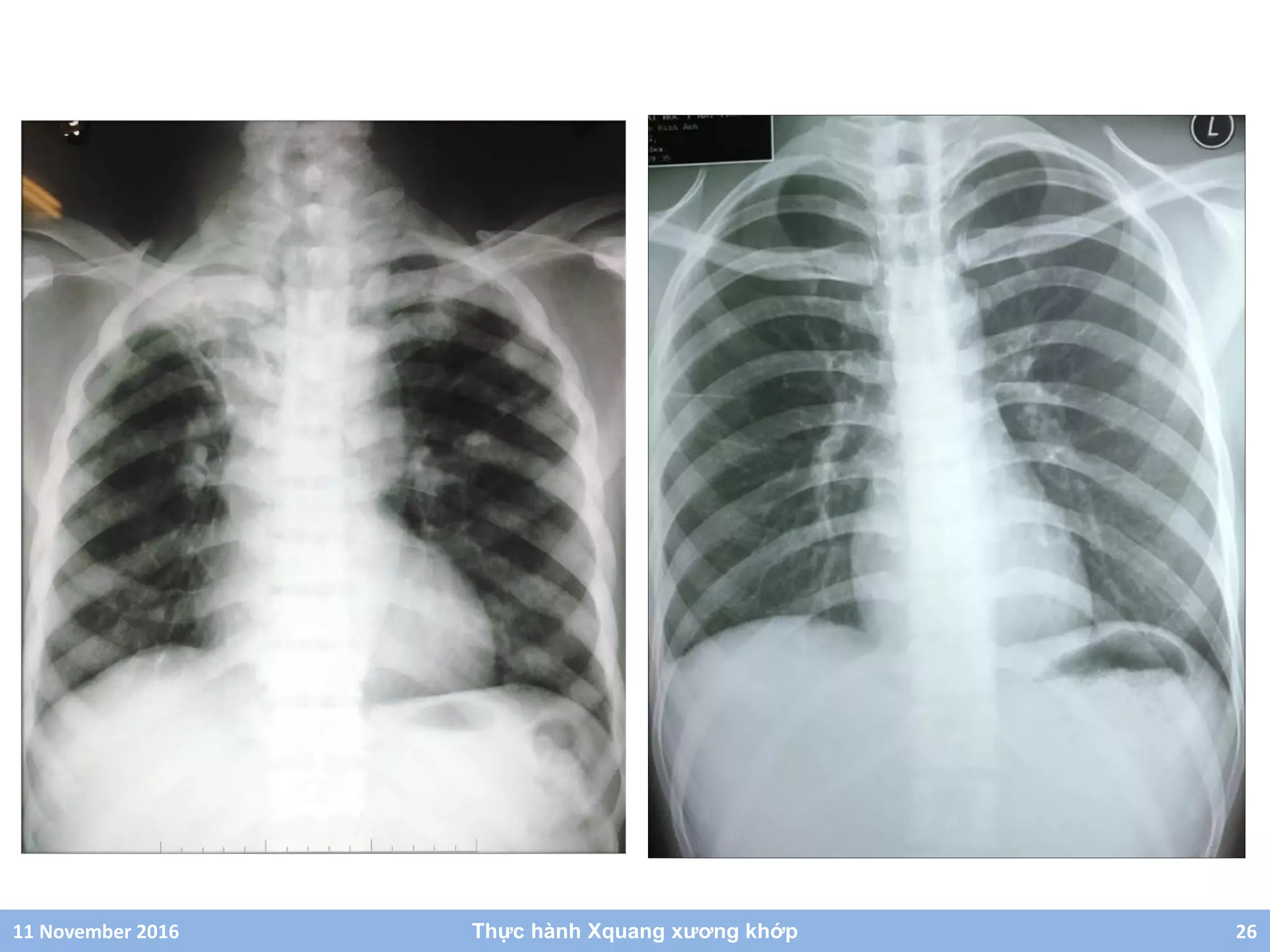 Thực hành X quang xương khớp | PDF