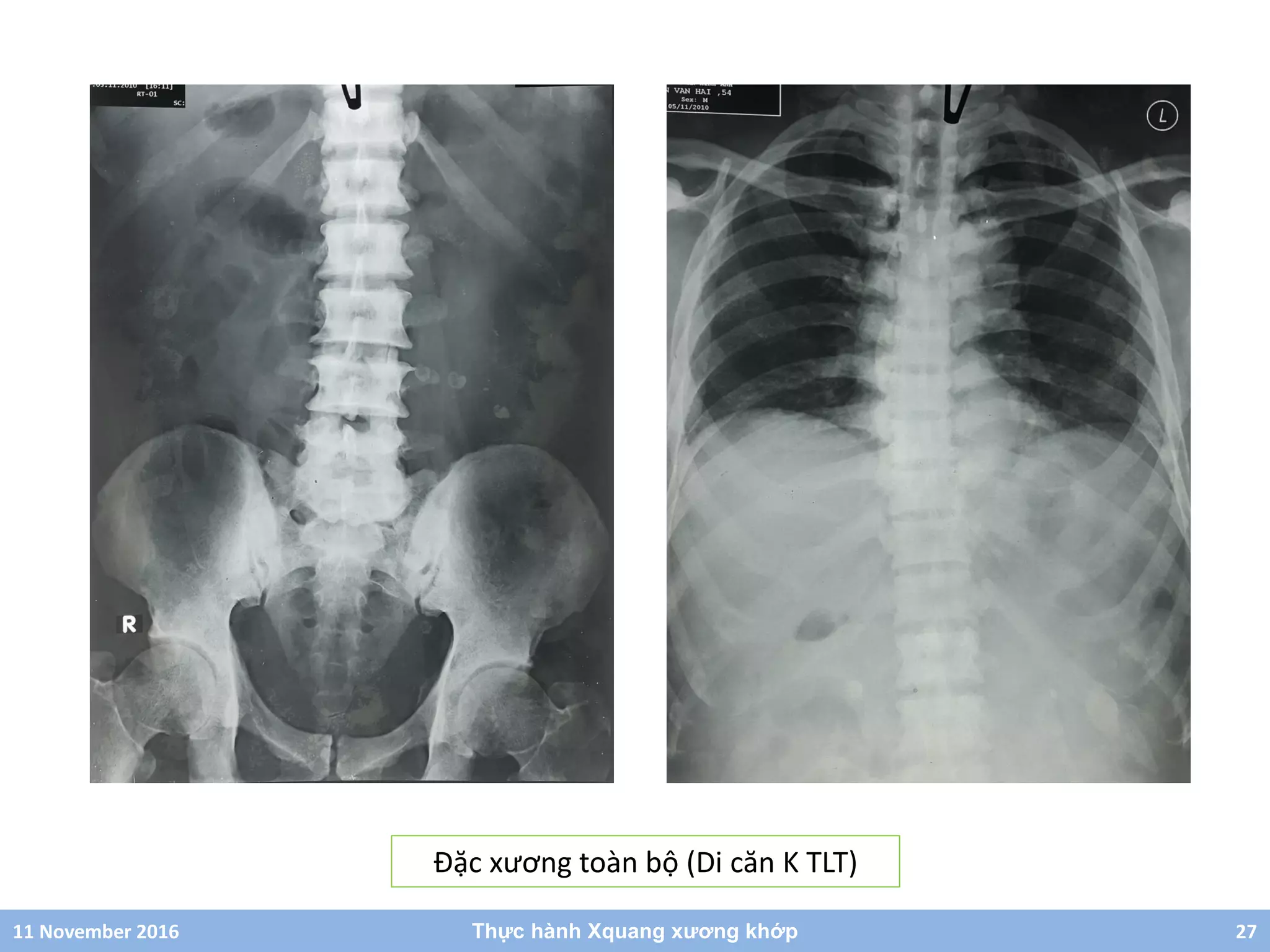 Thực hành X quang xương khớp | PDF