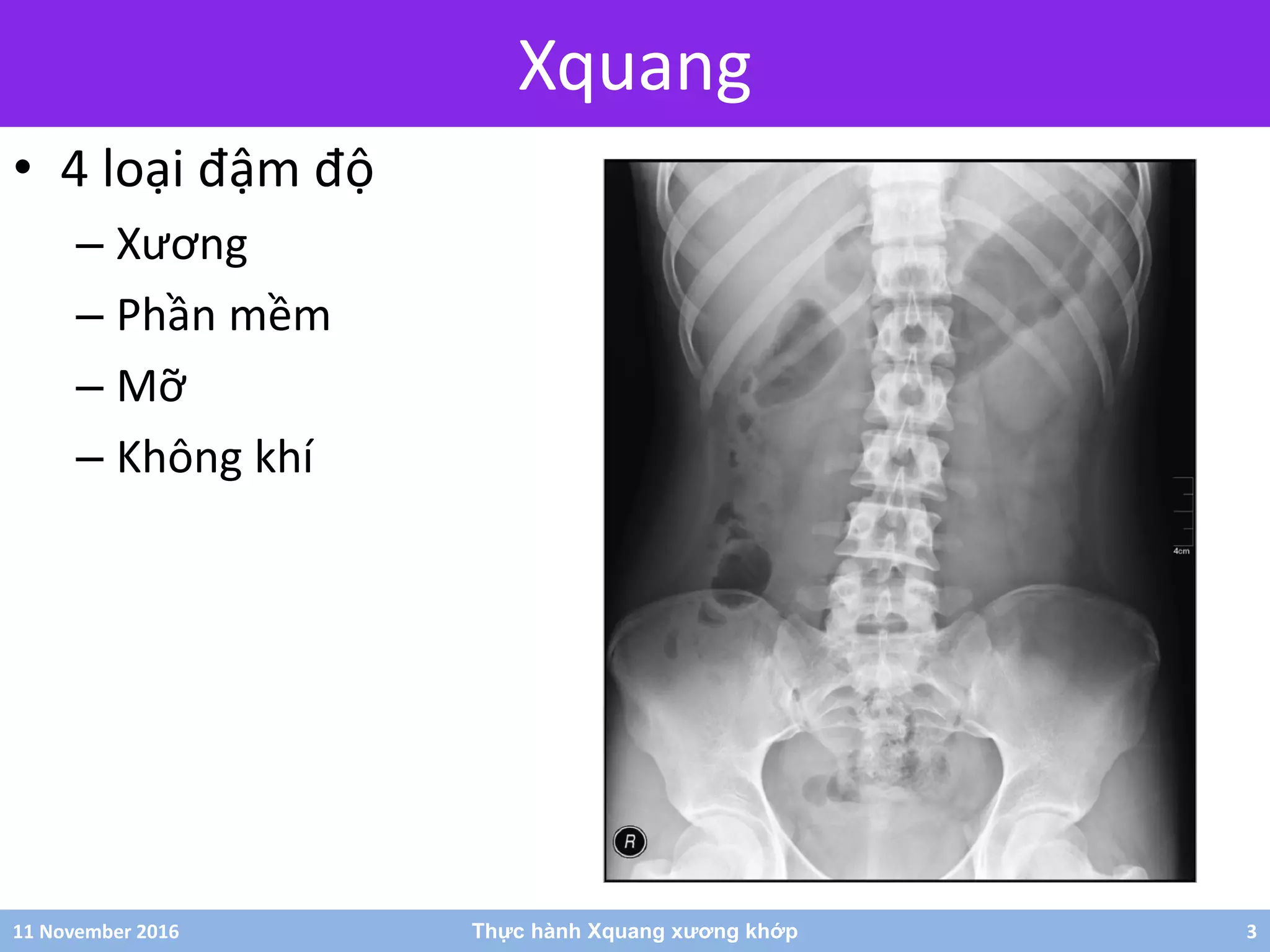 Thực hành X quang xương khớp | PDF