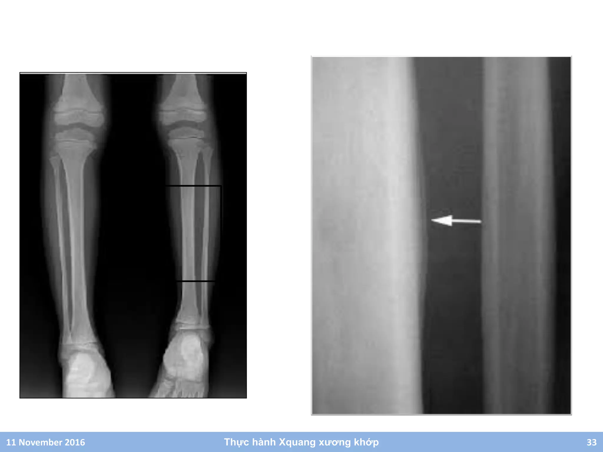 Thực hành X quang xương khớp | PDF