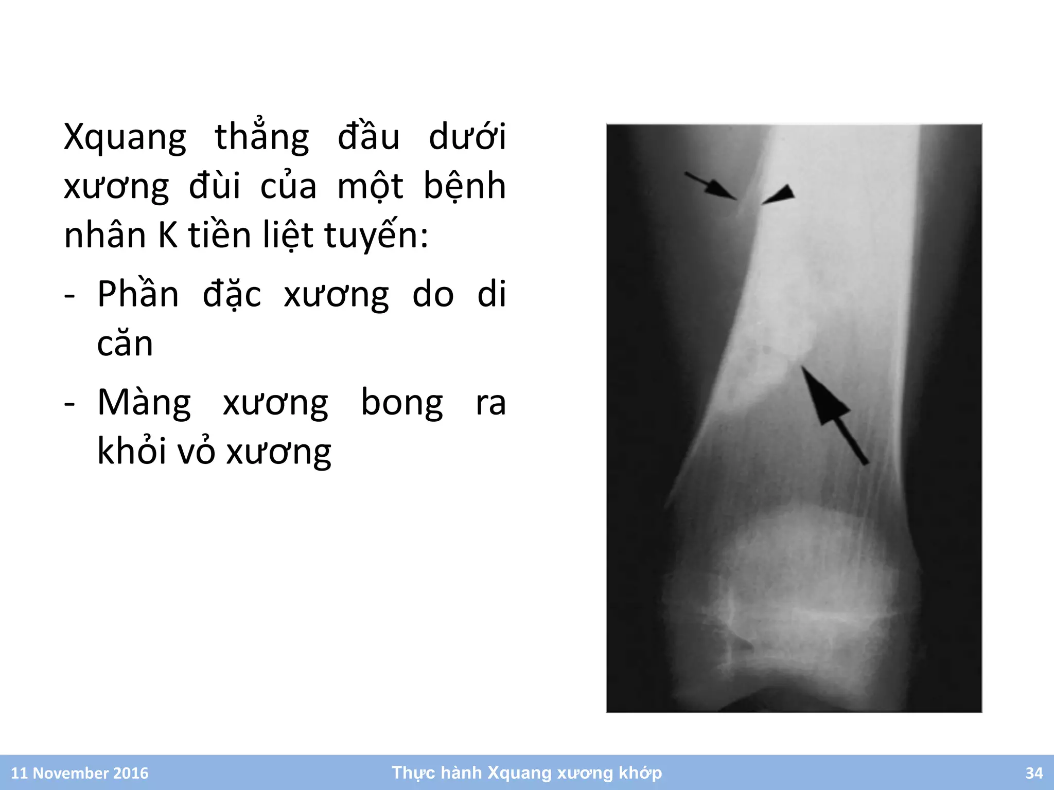 Thực hành X quang xương khớp | PDF