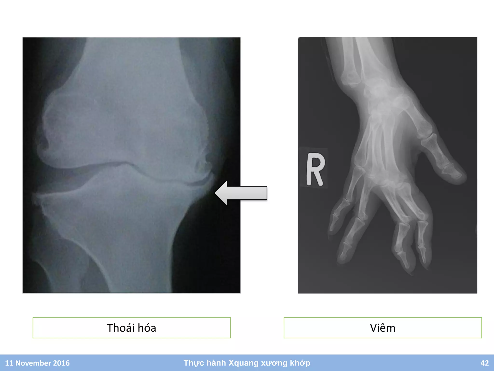 Thực hành X quang xương khớp | PDF